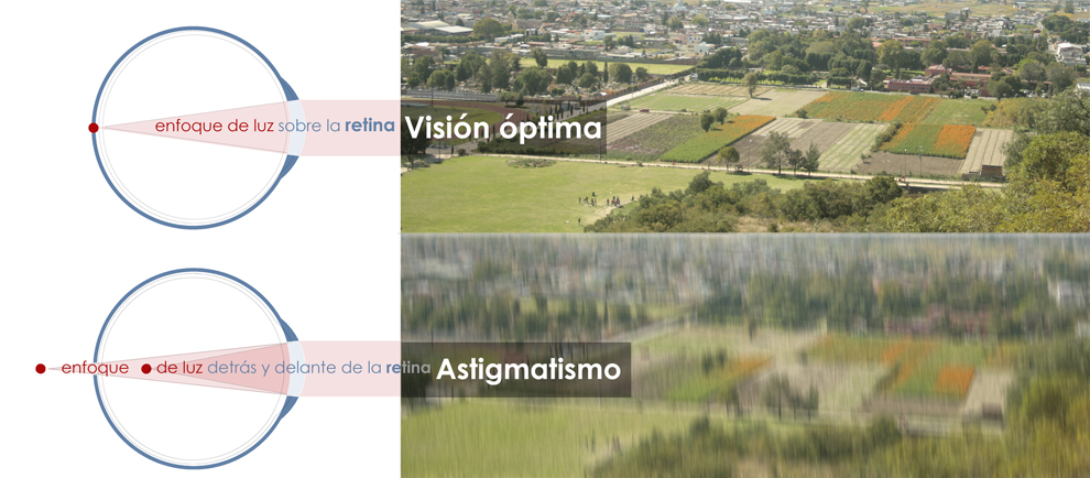 Astigmatismo - Centro de la Visión